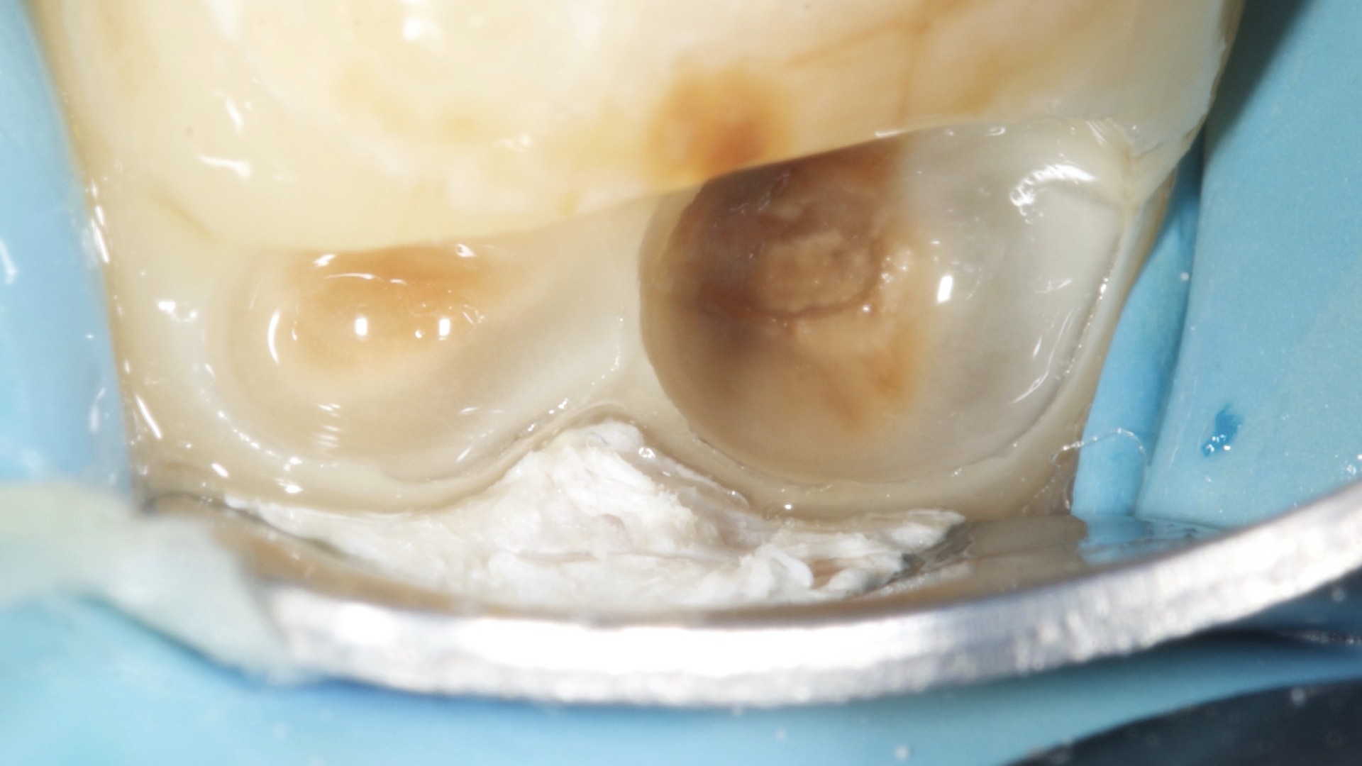 Digue | GAD Center | Leader en formation dentaire